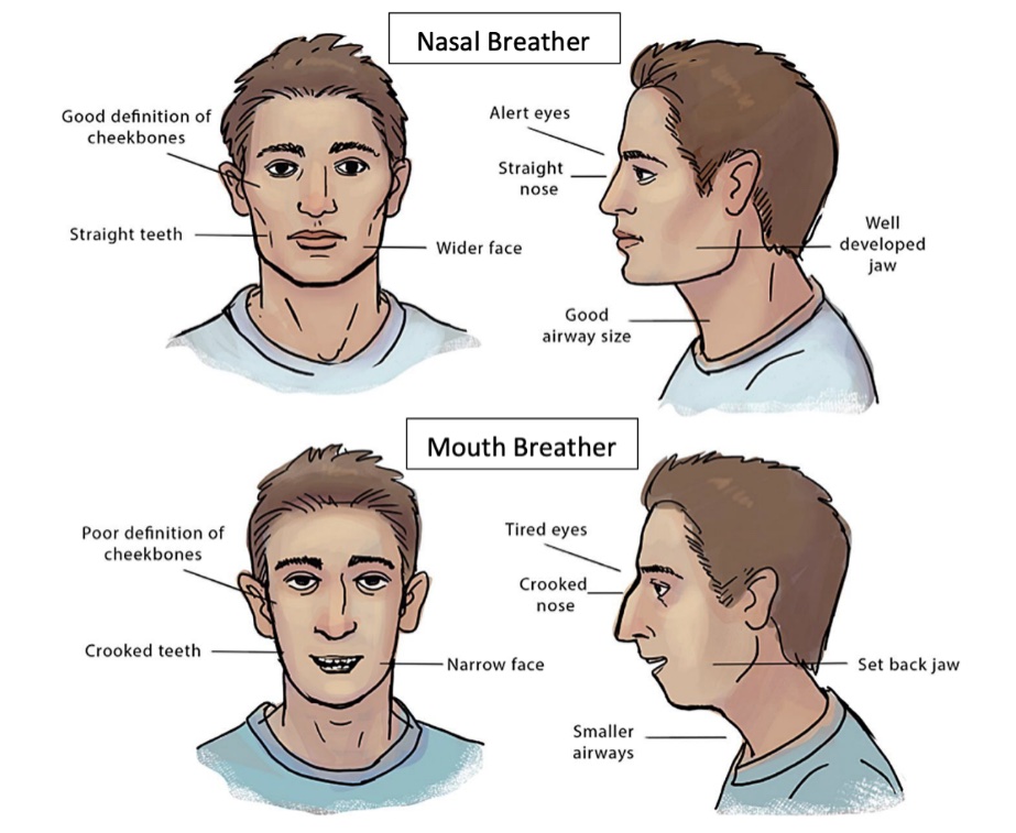 Teeth Alignment: ‘Rooted in Lifestyle, not Genetics’ - Next Level Rehab